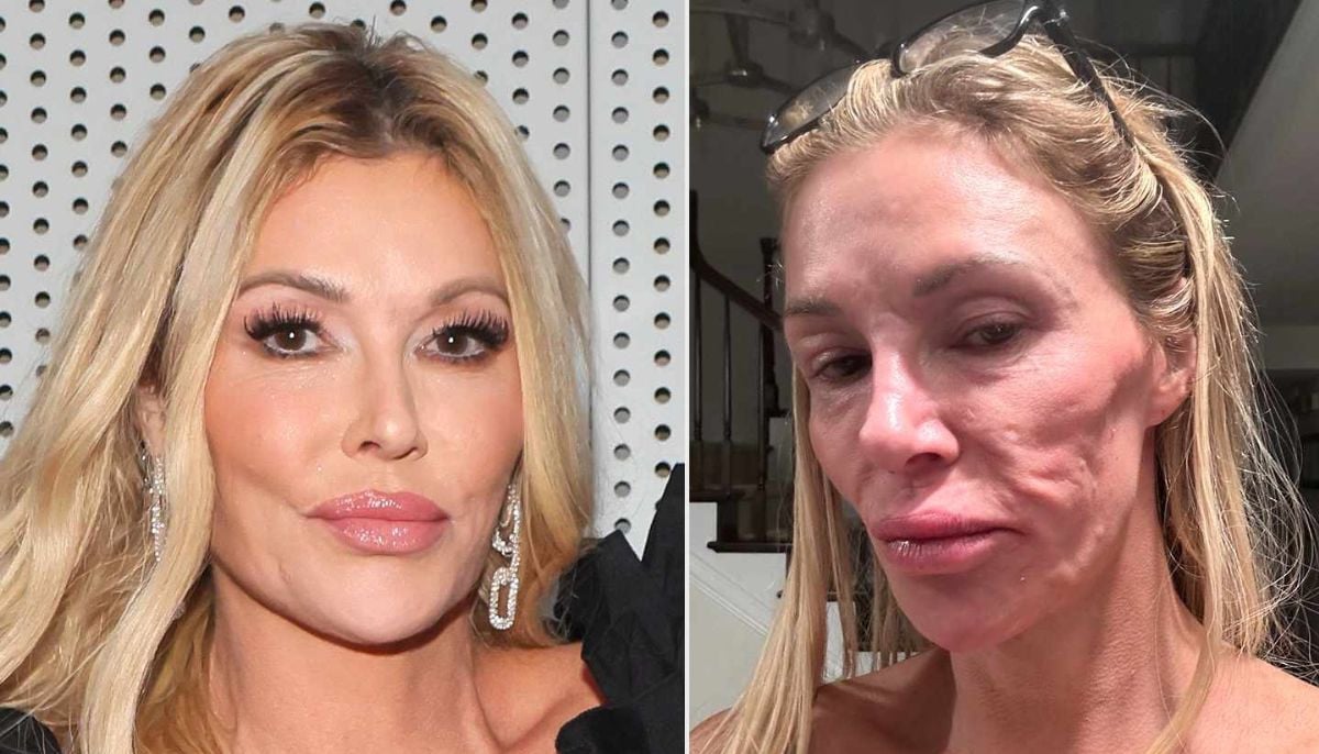 Brandi Glanville unveils new look for Sundance, credits plastic surgeon