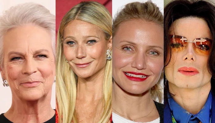 Celebrities and their Botox blunders: Stars whose facial fillers gone ...